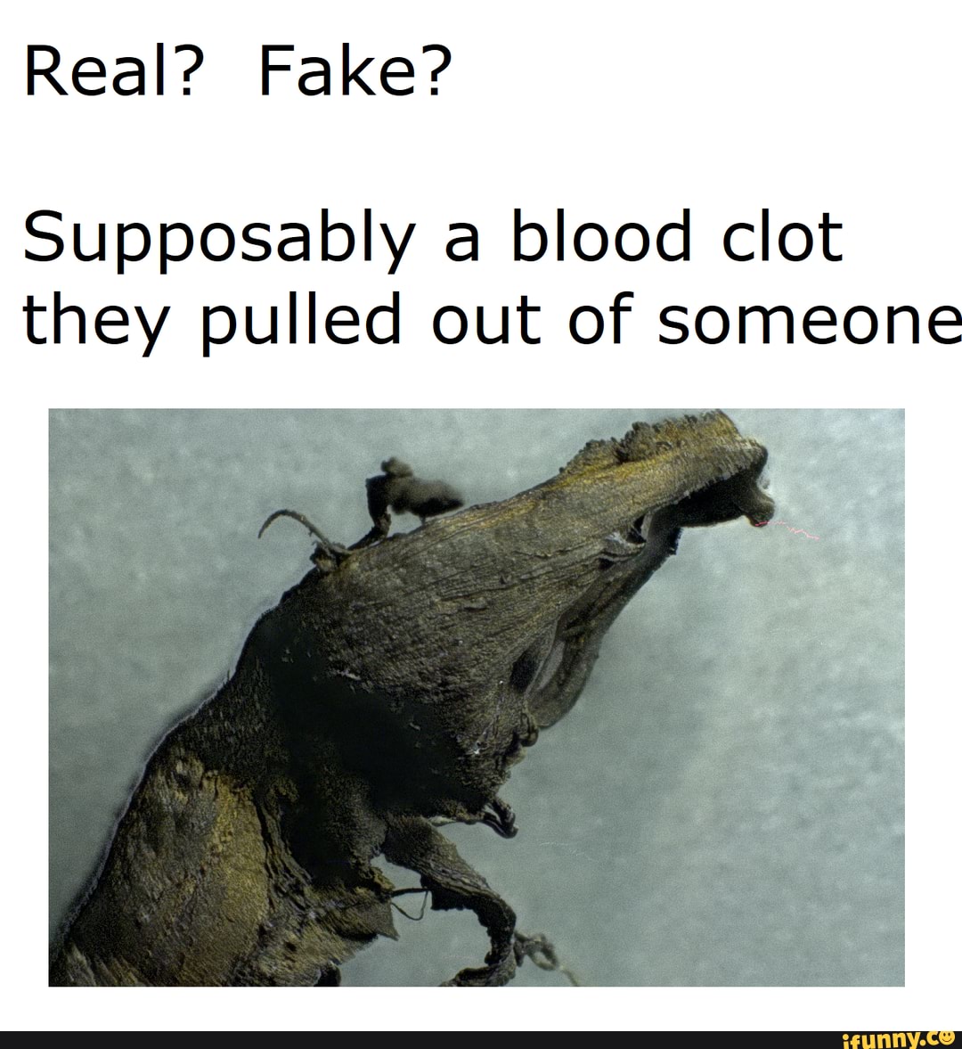 Real? Fake? Supposably a blood clot they pulled out of someone - iFunny