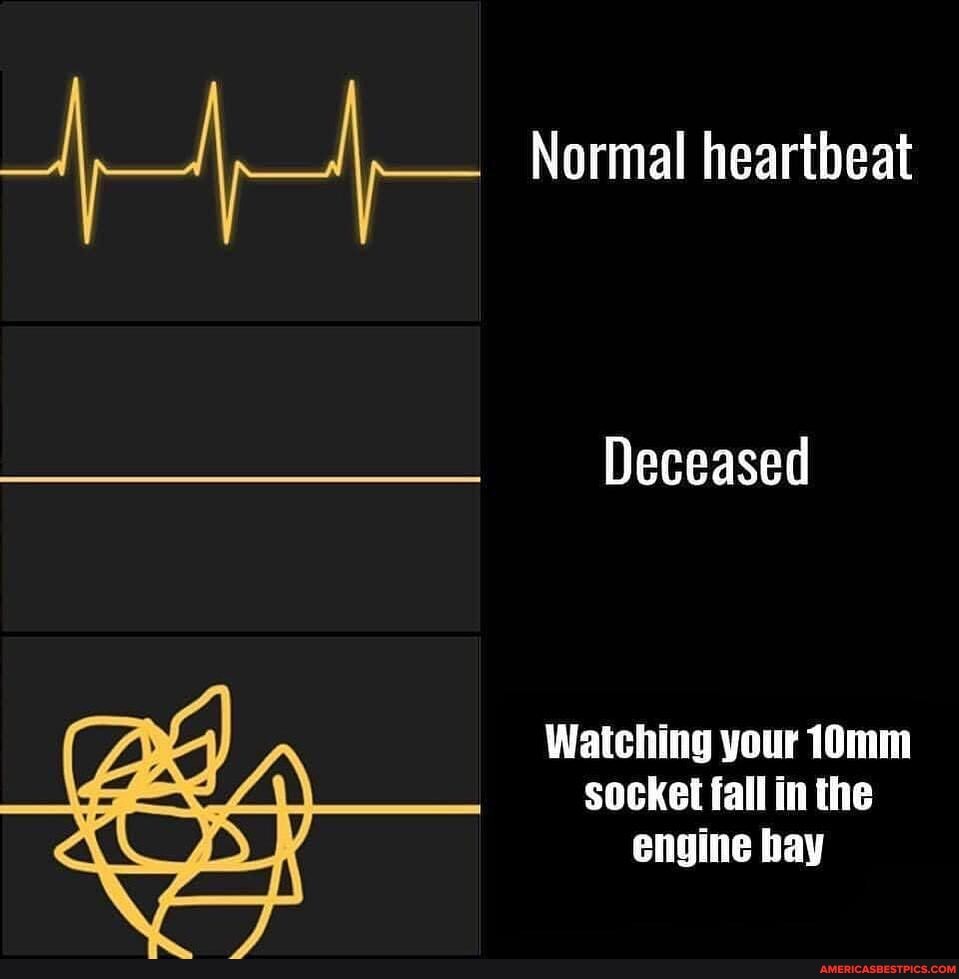 Normal heartbeat Deceased Watching your 10mm socket fall in the engine ...