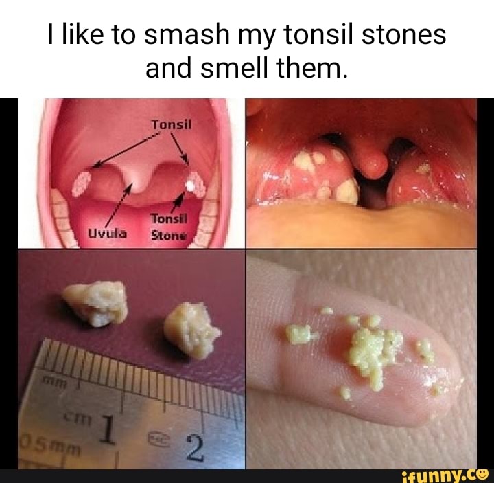 Tonsil memes. Best Collection of funny Tonsil pictures on iFunny