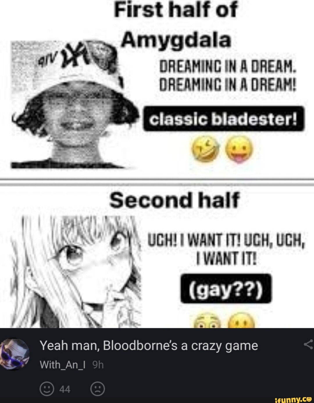 Amygdala memes. Best Collection of funny Amygdala pictures on iFunny