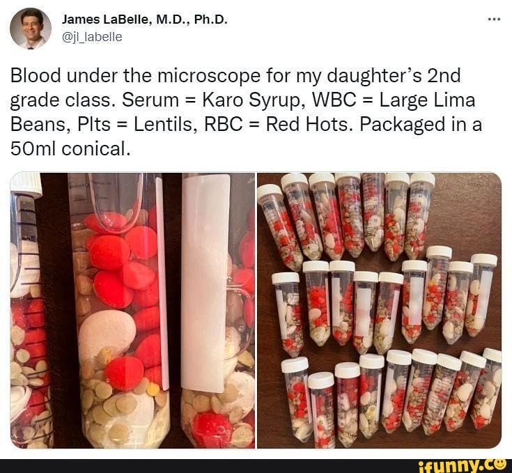 James Blood under the microscope for my daughter's grade class. Serum ...