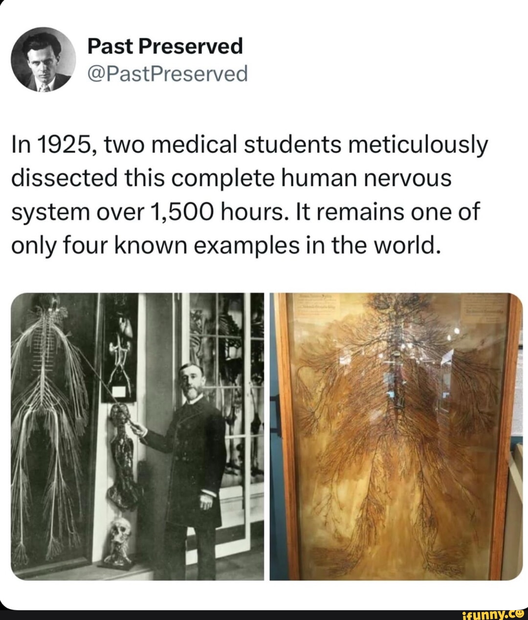Past Preserved In 1925, two medical students meticulously dissected ...