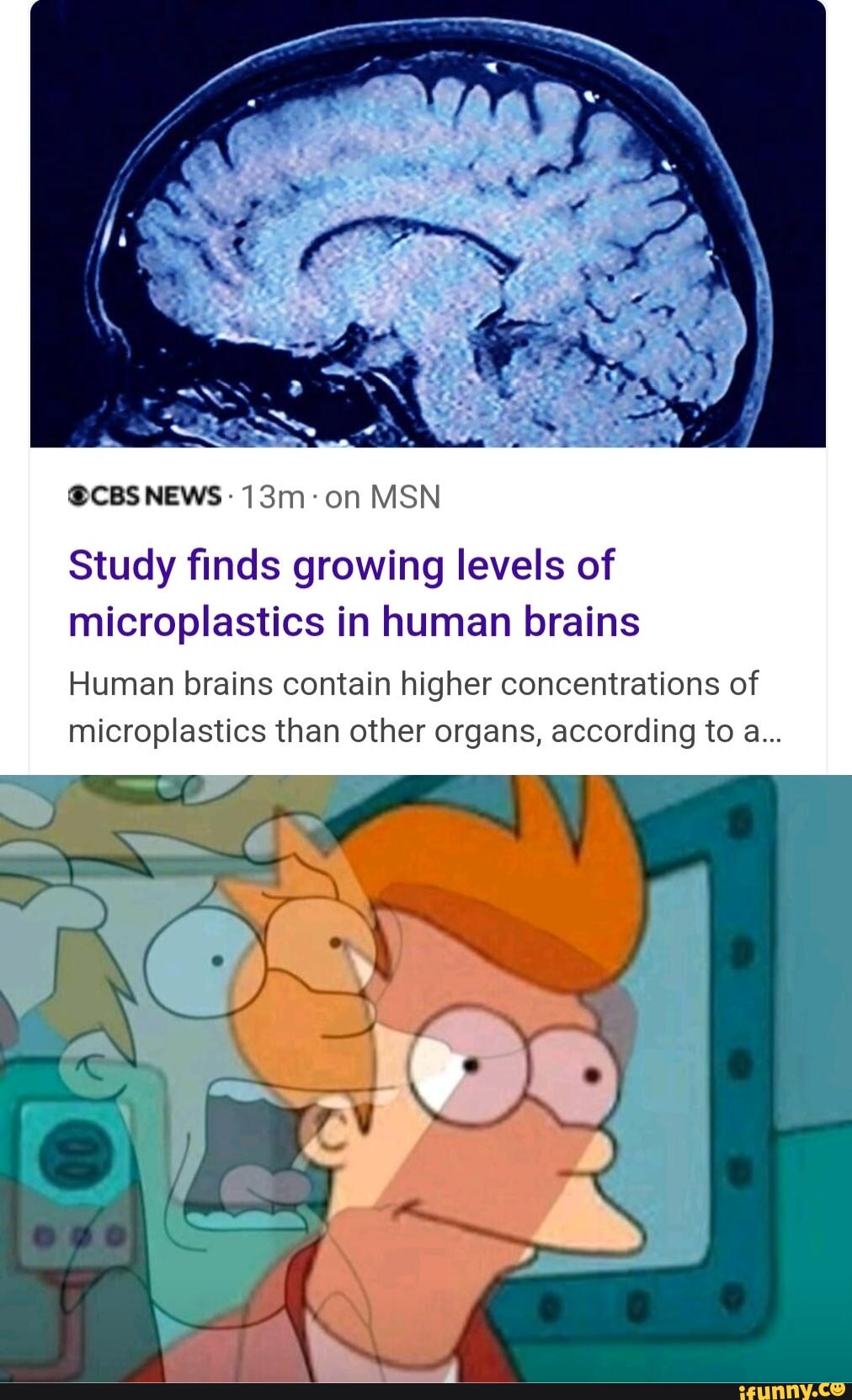 CBS NEWS on MSN Study finds growing levels of microplastics in human ...