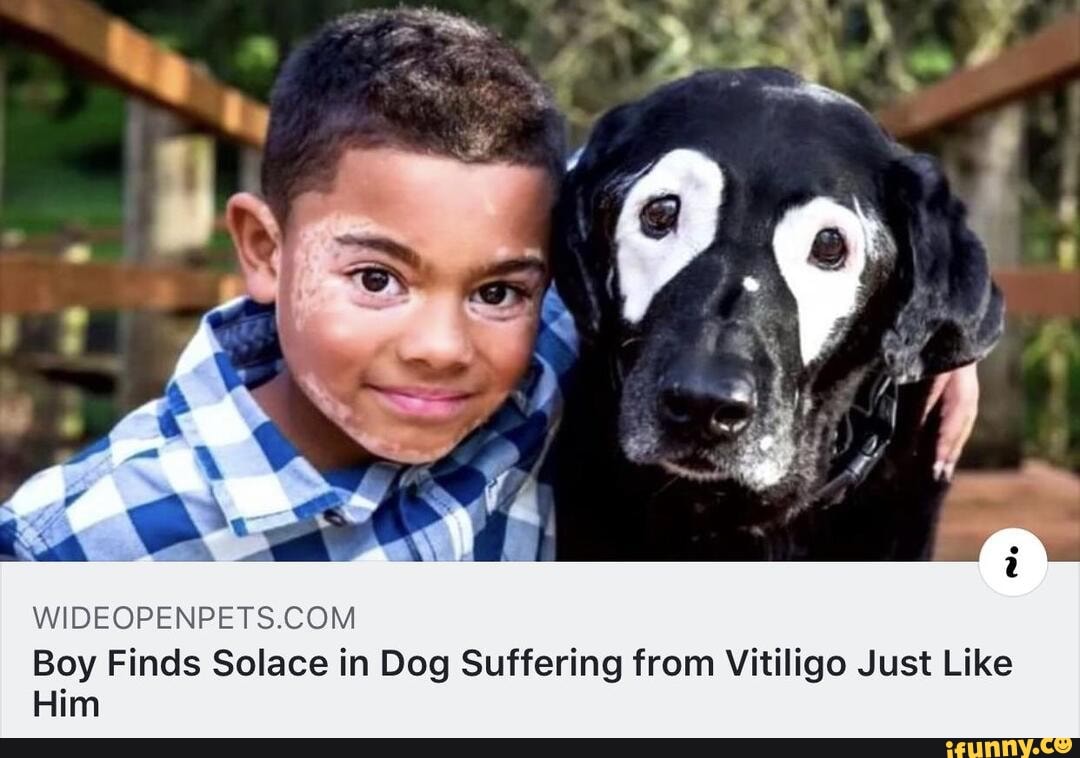 Vitiligo memes. Best Collection of funny Vitiligo pictures on iFunny