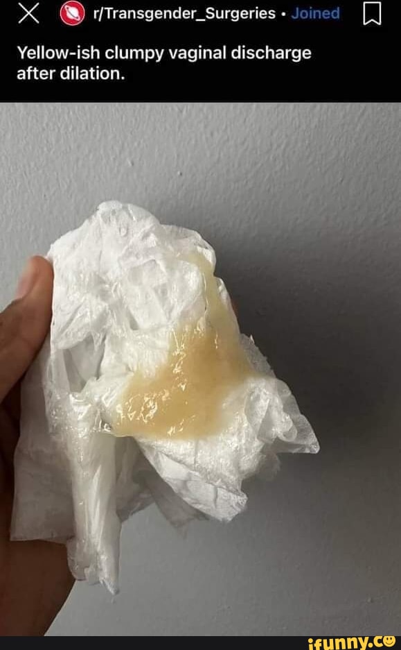 & fTransgender_Surgeries - Joined Yellow-ish clumpy vaginal discharge ...
