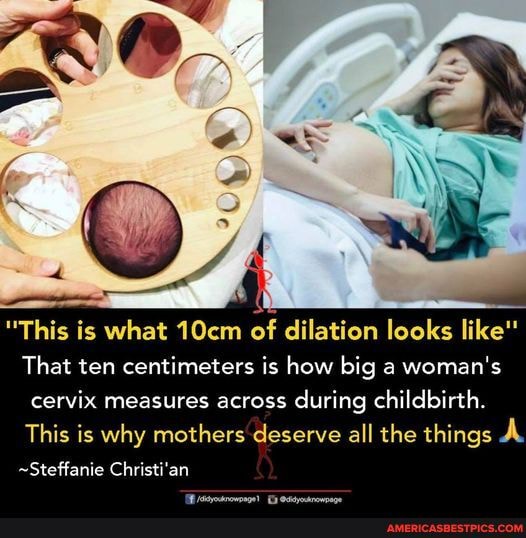 "This is what 10cm of dilation looks like" That ten centimeters is how big a woman's cervix ...