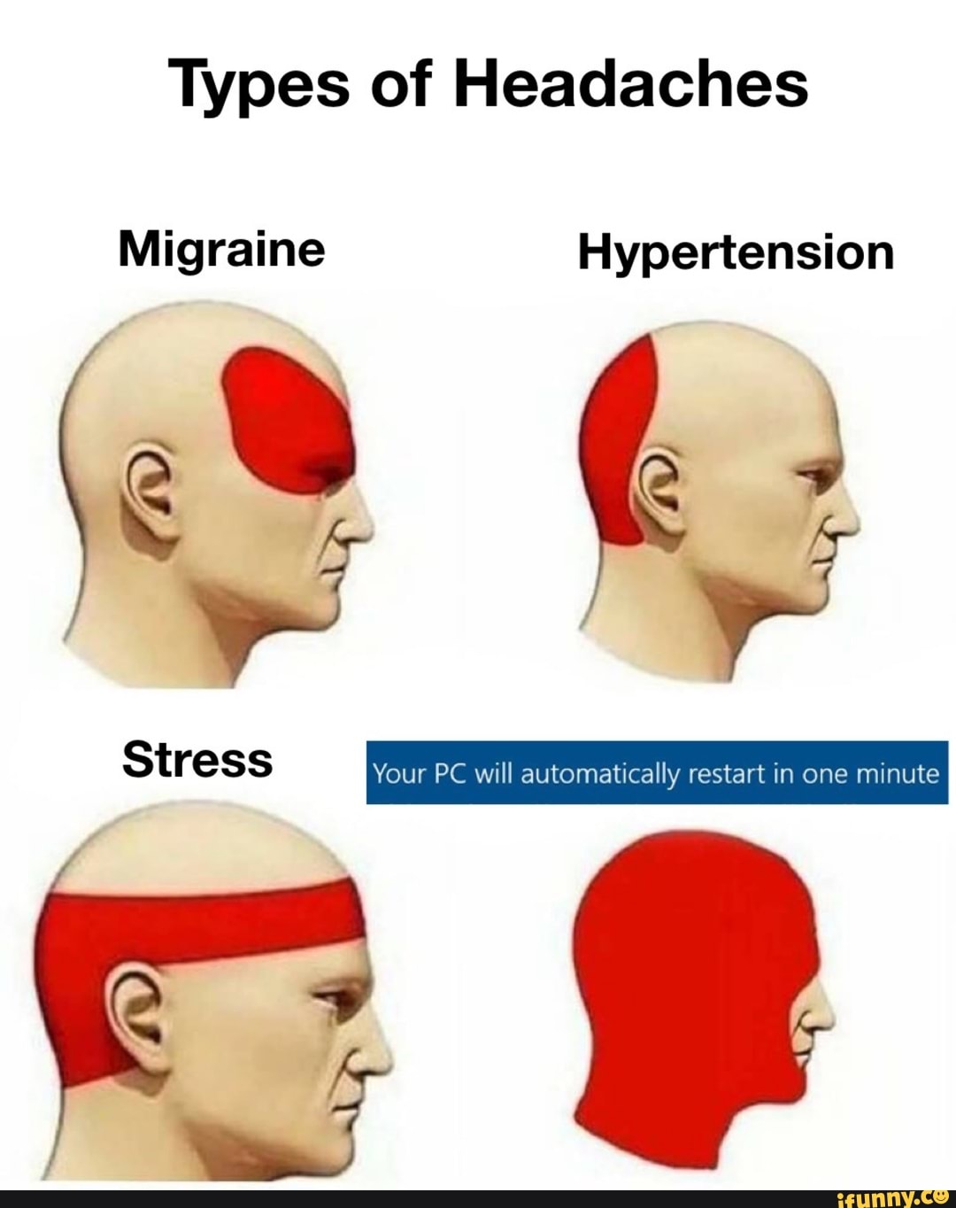 Types of Headaches Migraine Hypertension Stress Your PC will Your Your ...