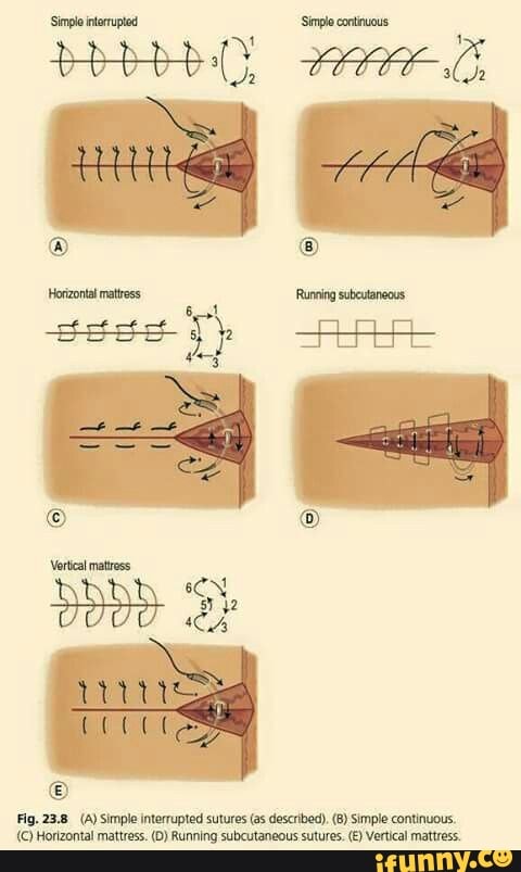 Sutures memes. Best Collection of funny Sutures pictures on iFunny