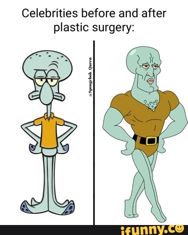 Celebrities before and after plastic surgery: - iFunny
