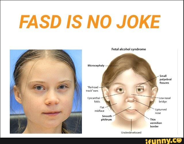 Fasd memes. Best Collection of funny Fasd pictures on iFunny