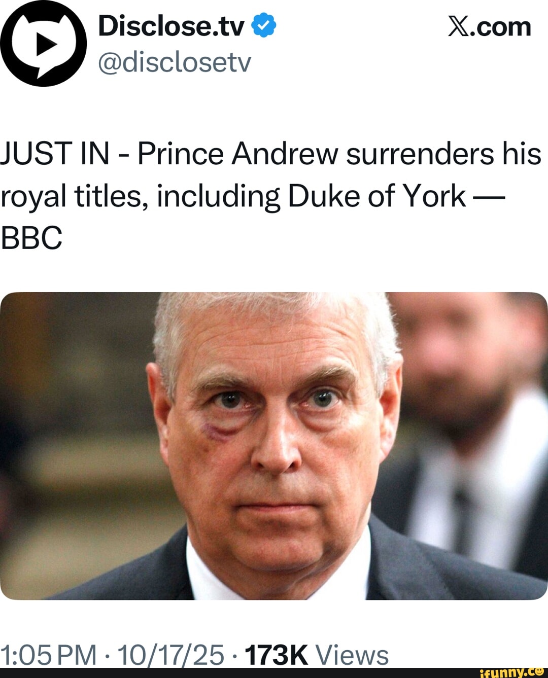 Disclose.tv X.com @disclosetv BBC JUST IN - Prince Andrew surrenders ...