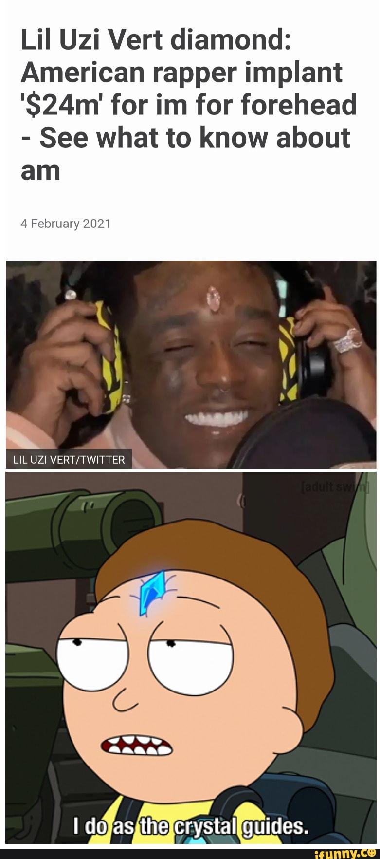 Lil Uzi Vert diamond: American rapper implant for im for forehead - See ...
