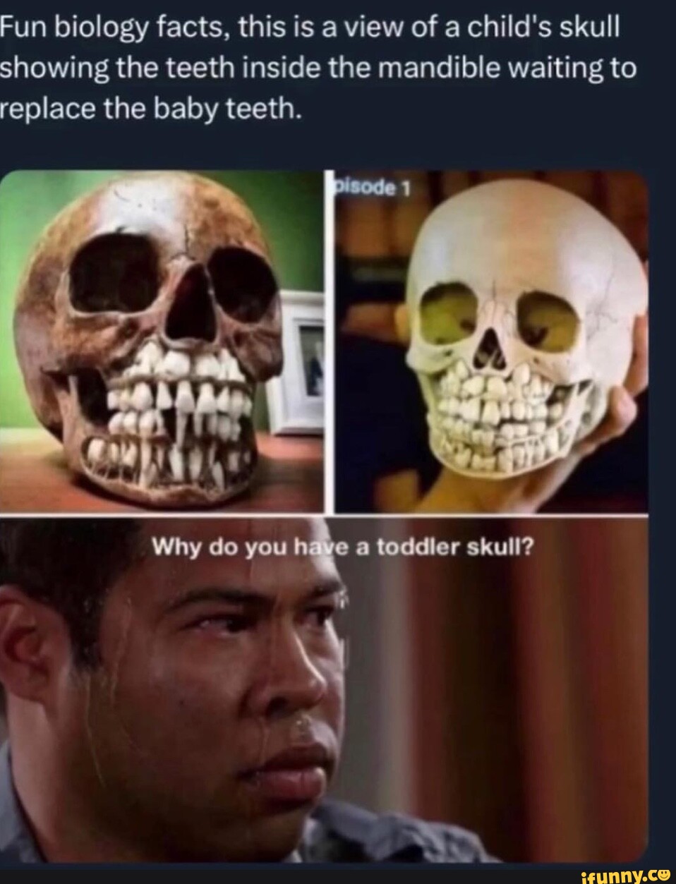 Fun biology facts, this is a view of a child's skull showing the teeth ...