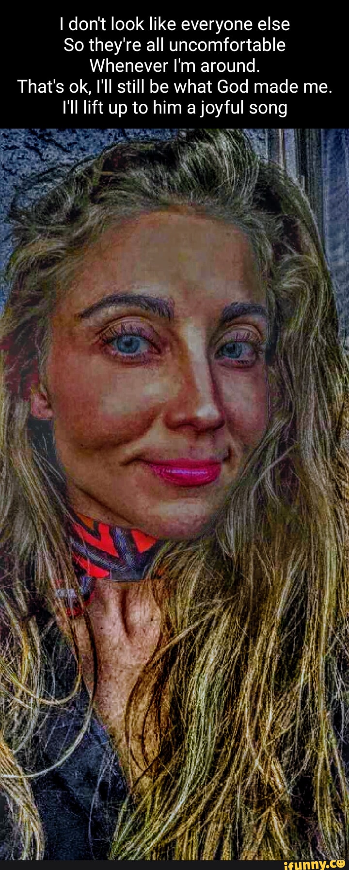 I don't look like everyone else So they're all uncomfortable Whenever I ...