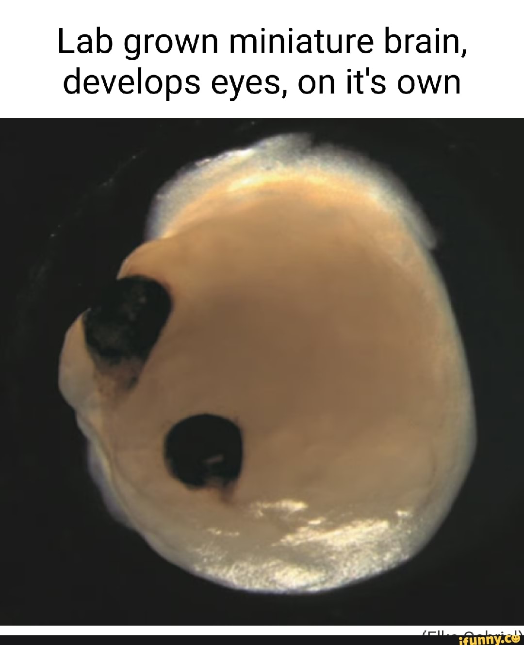 Lab grown miniature brain, develops eyes, on it's own - iFunny