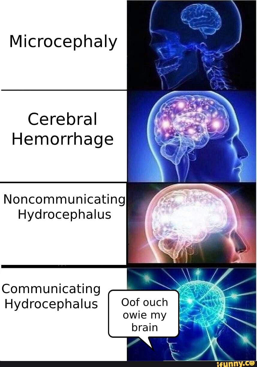 Microcephaly Cerebral Hemorrhage Noncommunicating Hydrocephalus ...