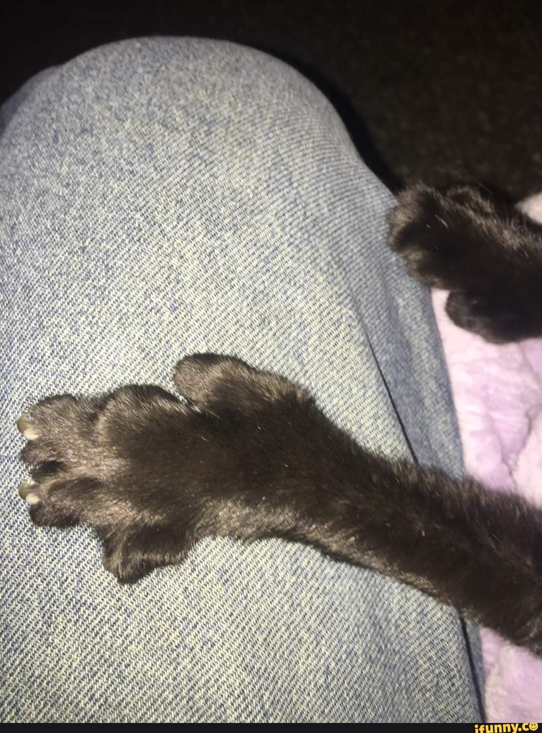 Polydactyly memes. Best Collection of funny Polydactyly pictures on iFunny