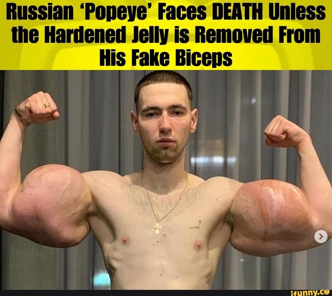 Russian 'Popeye' Faces DEATH Uniess the Hardened Jelly is Removed From ...