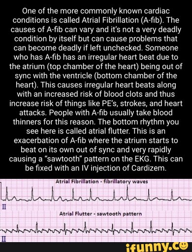 Fibrillation memes. Best Collection of funny Fibrillation pictures on ...