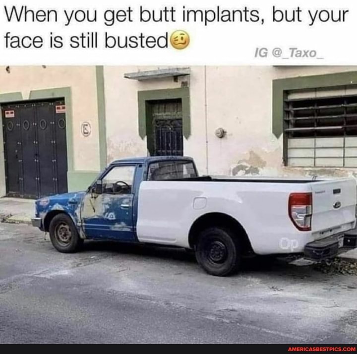 When you get butt implants, but your face is still busted@ - America’s ...
