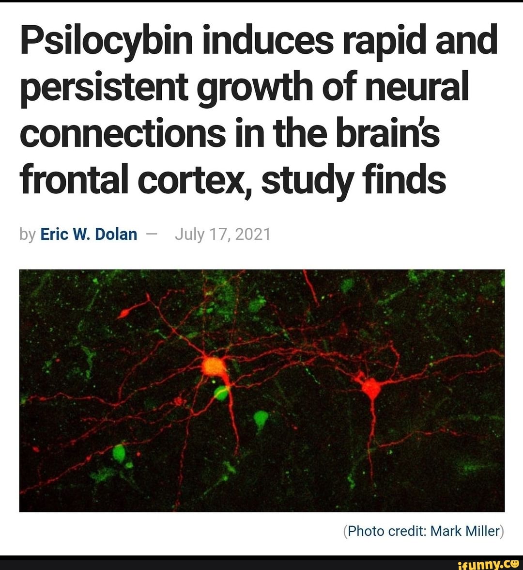 Neuroplasticity memes. Best Collection of funny Neuroplasticity ...