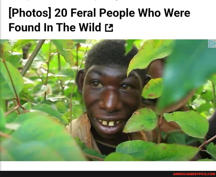 [Photos] 20 Feral People Who Were Found In The Wild - America’s best ...
