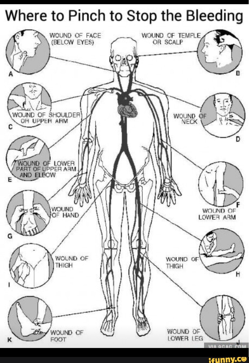Where to Pinch to Stop the Bleeding WOUND OF FACE WoUND TEMPLE (BELOW ...