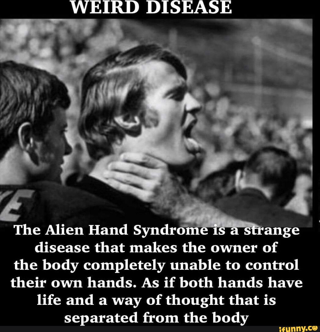 WEIRD DISEASE The Alien Hand Syndrome is a strange disease that makes ...