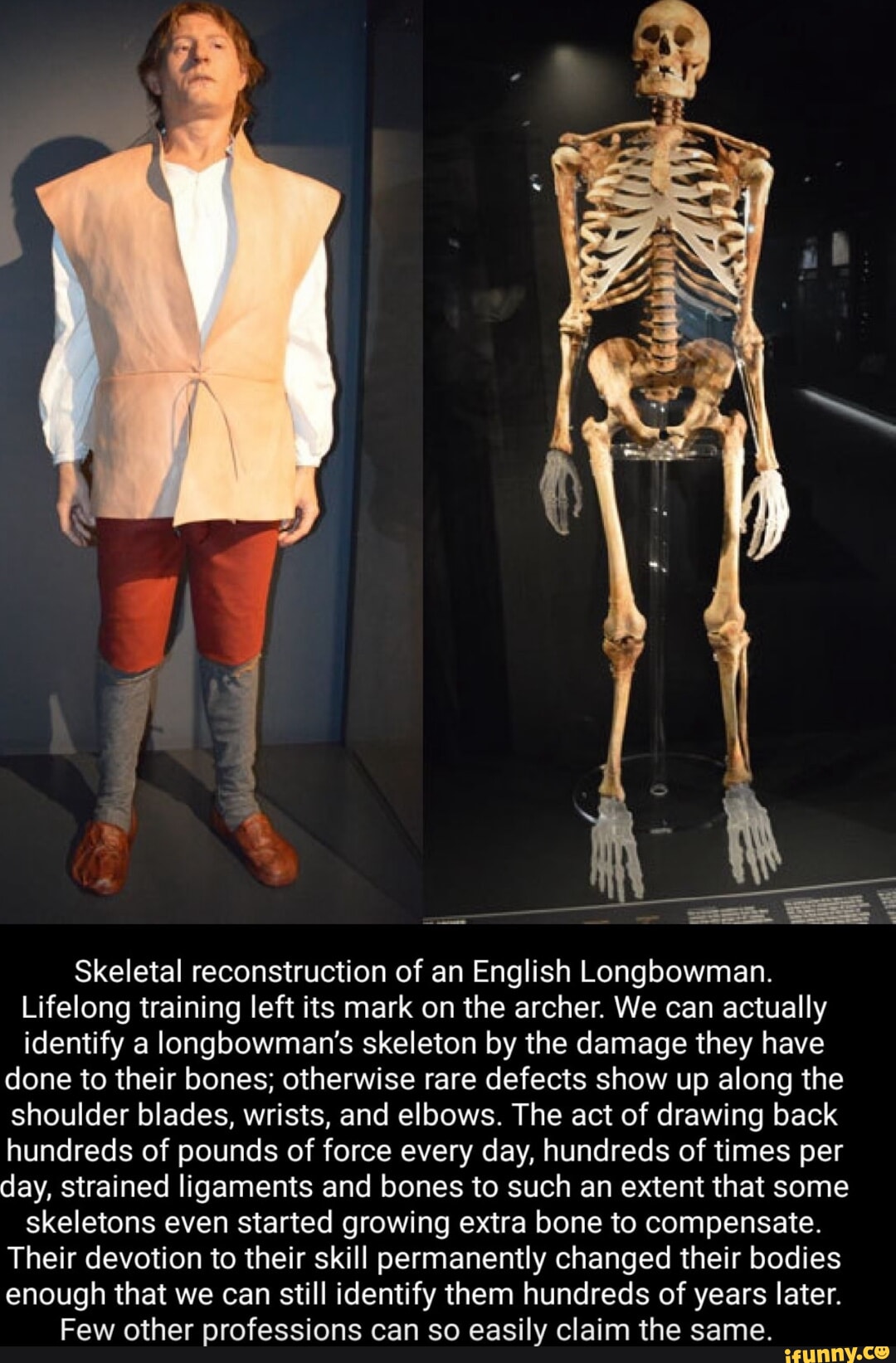 Skeletal reconstruction of an English Longbowman. Lifelong training ...