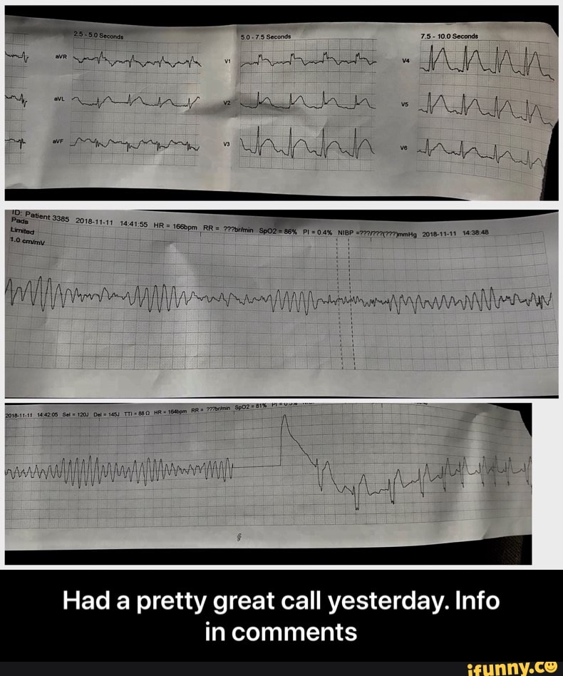 Myocardialinfarction memes. Best Collection of funny ...