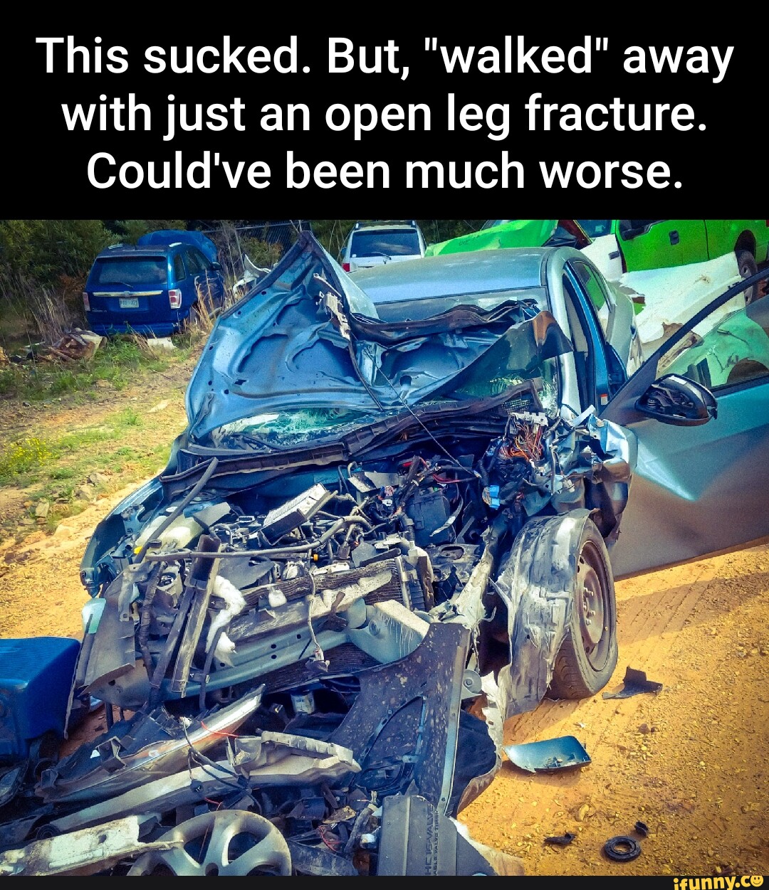This sucked. But, "walked" away with just an open leg fracture. Could ...