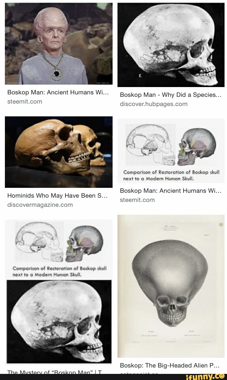 Boskop Man: Ancient Humans Wi... Boskop Man - Why Did a Species ...