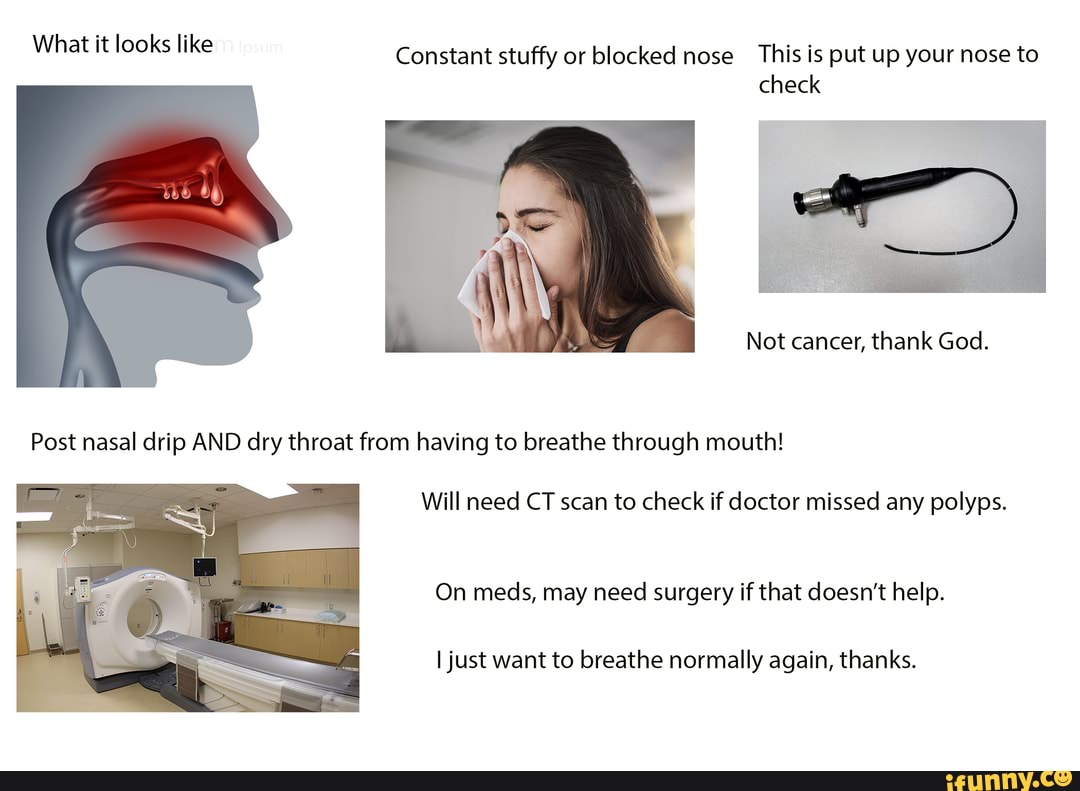 Polyps memes. Best Collection of funny Polyps pictures on iFunny