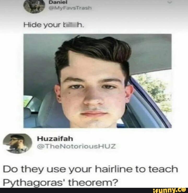@MyFavstTrash Hide your Do they use your hairline to teach Pythagoras ...