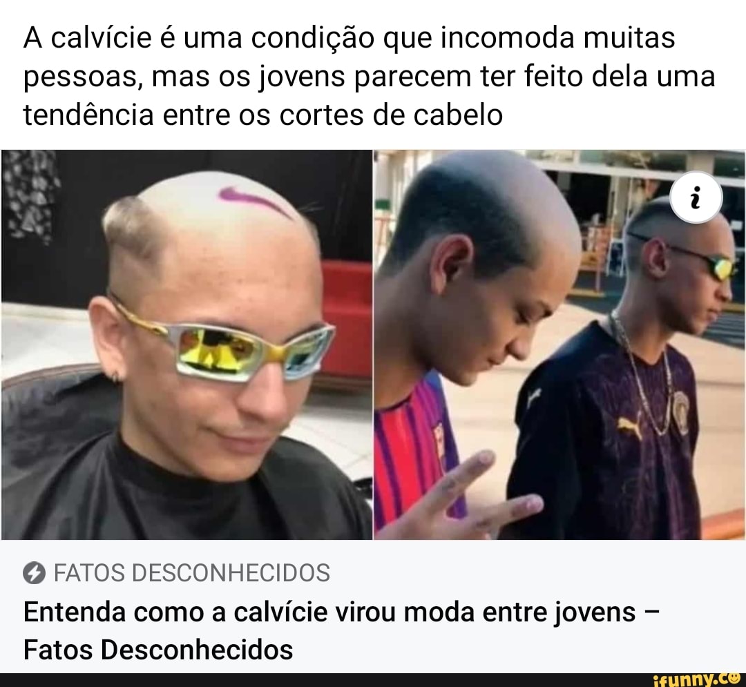 A calvície é uma condição que incomoda muitas pessoas, mas os jovens ...