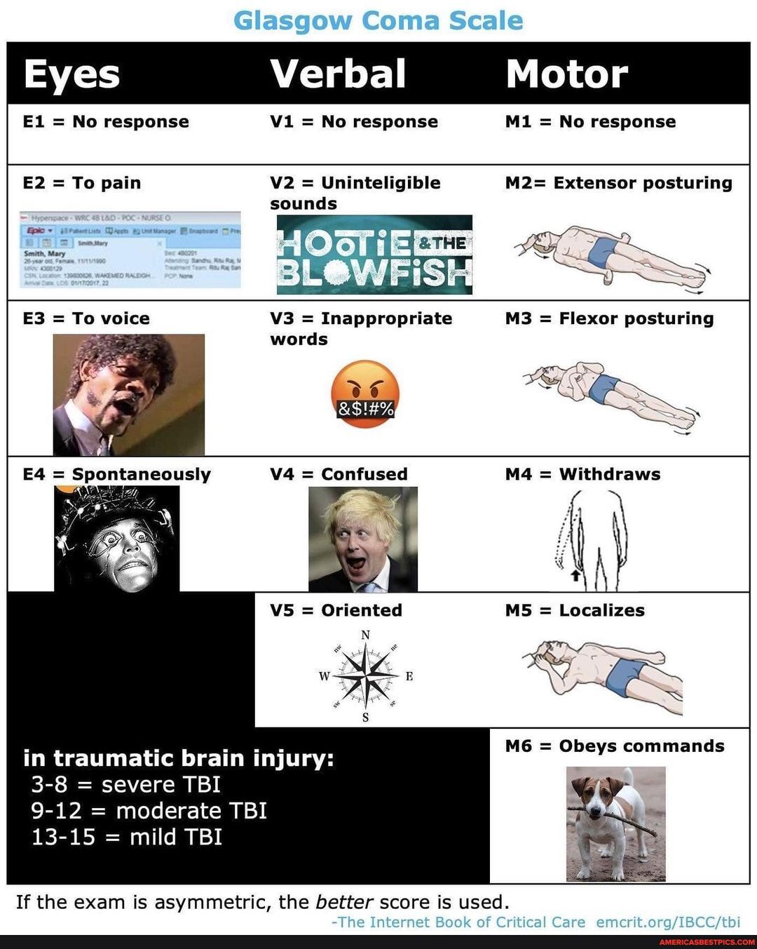 Glasgow Coma Scale Verbal Vi = No response = No response Motor Mi = No ...