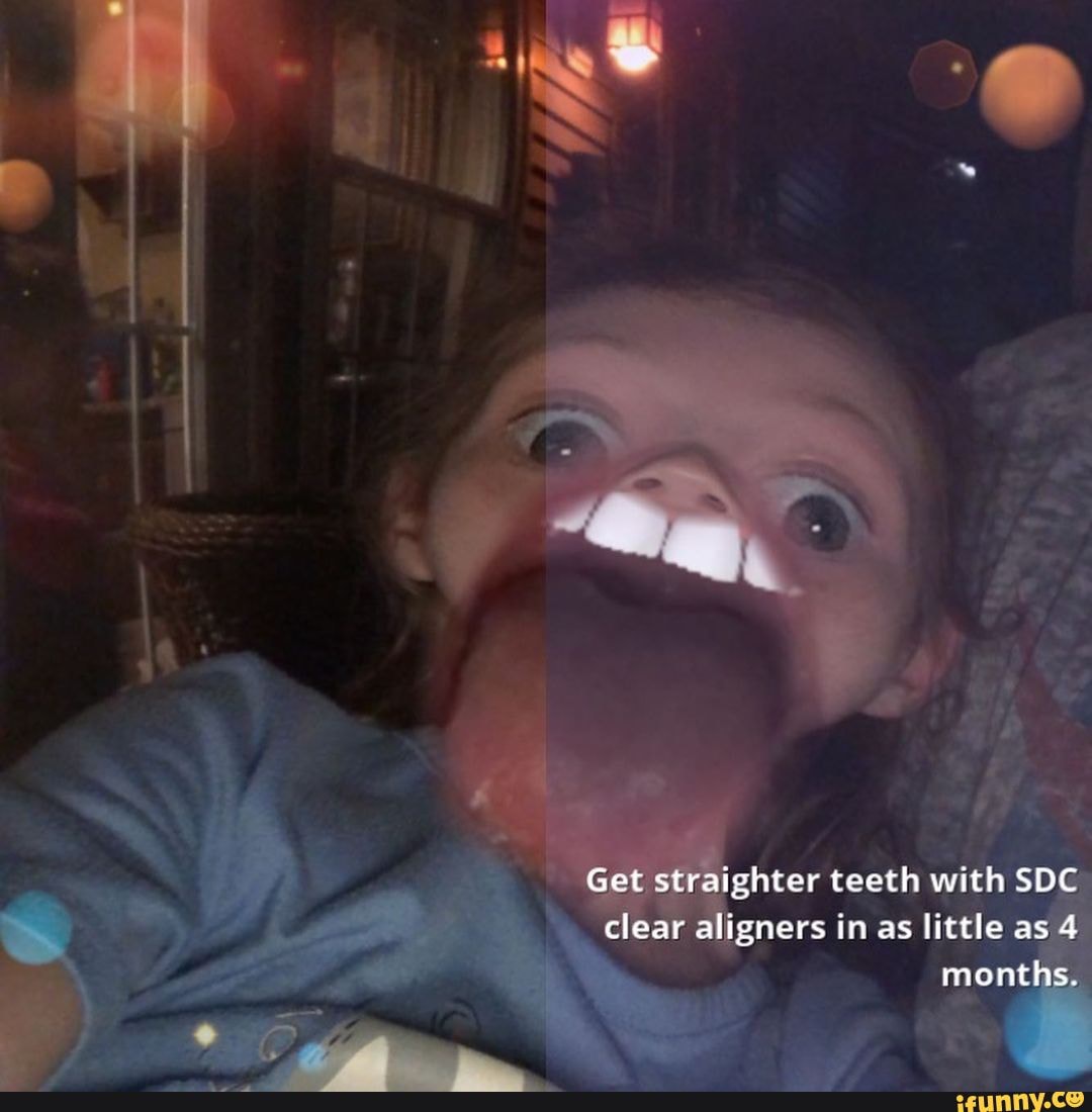Aligners memes. Best Collection of funny Aligners pictures on iFunny