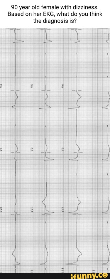 EKG memes. Best Collection of funny EKG pictures on iFunny