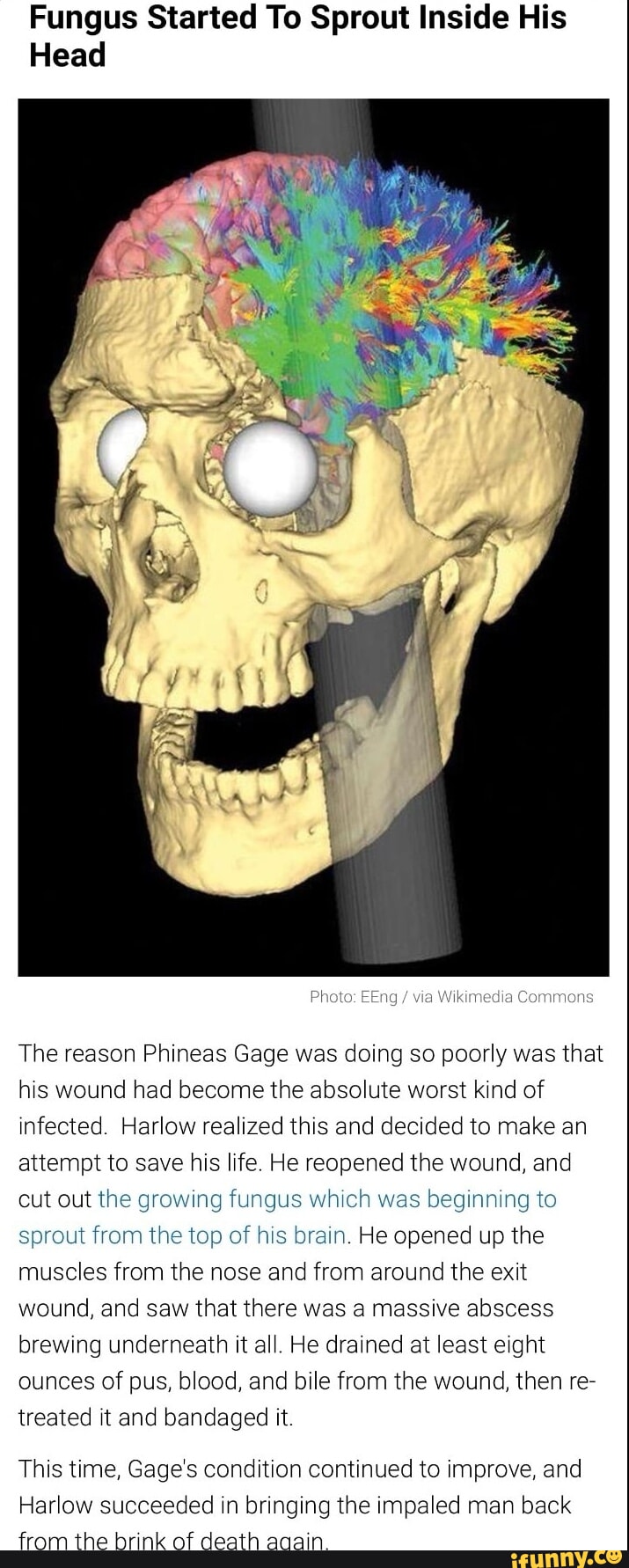 Fungus Started To Sprout Inside His Head EEng via Wikiredia Commens The ...