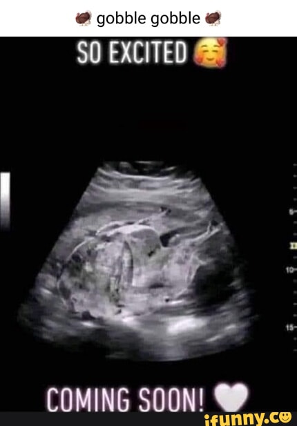 Sonogram memes. Best Collection of funny Sonogram pictures on iFunny
