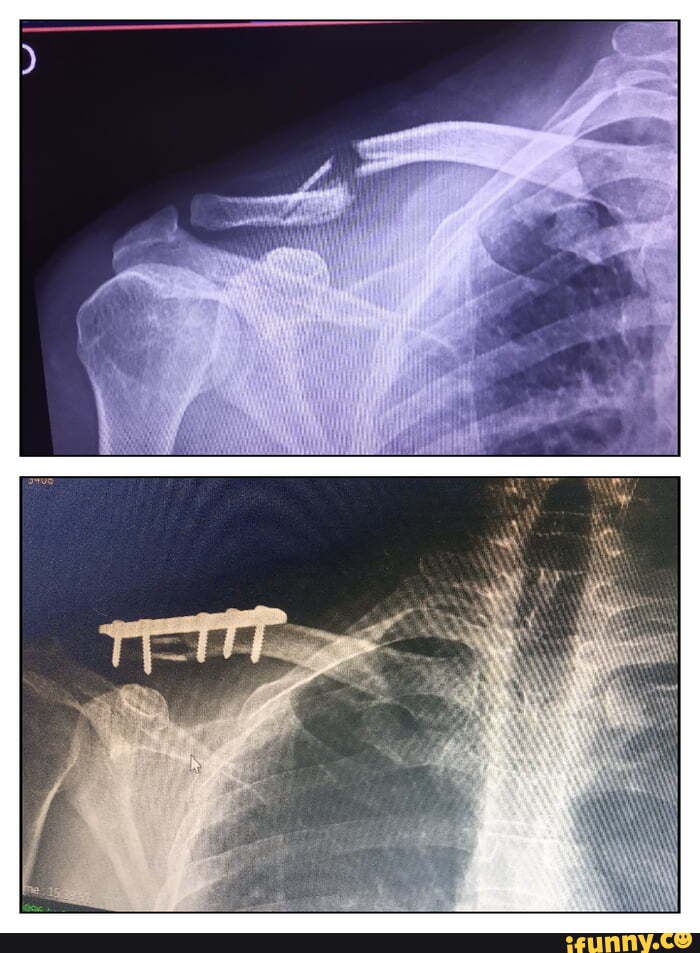 X_ray memes. Best Collection of funny X_ray pictures on iFunny