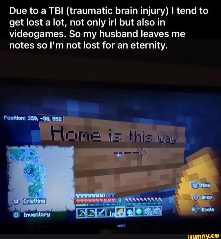 Tbi memes. Best Collection of funny Tbi pictures on iFunny