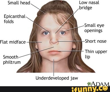 Midface memes. Best Collection of funny Midface pictures on iFunny