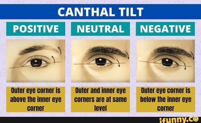 CANTHAL TILT POSITIVE NEUTRAL I I NEGATIVE I Outer eye corner is Outer ...