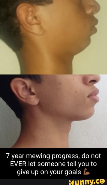 AS 7 year mewing progress, do not EVER let someone tell you to give up ...