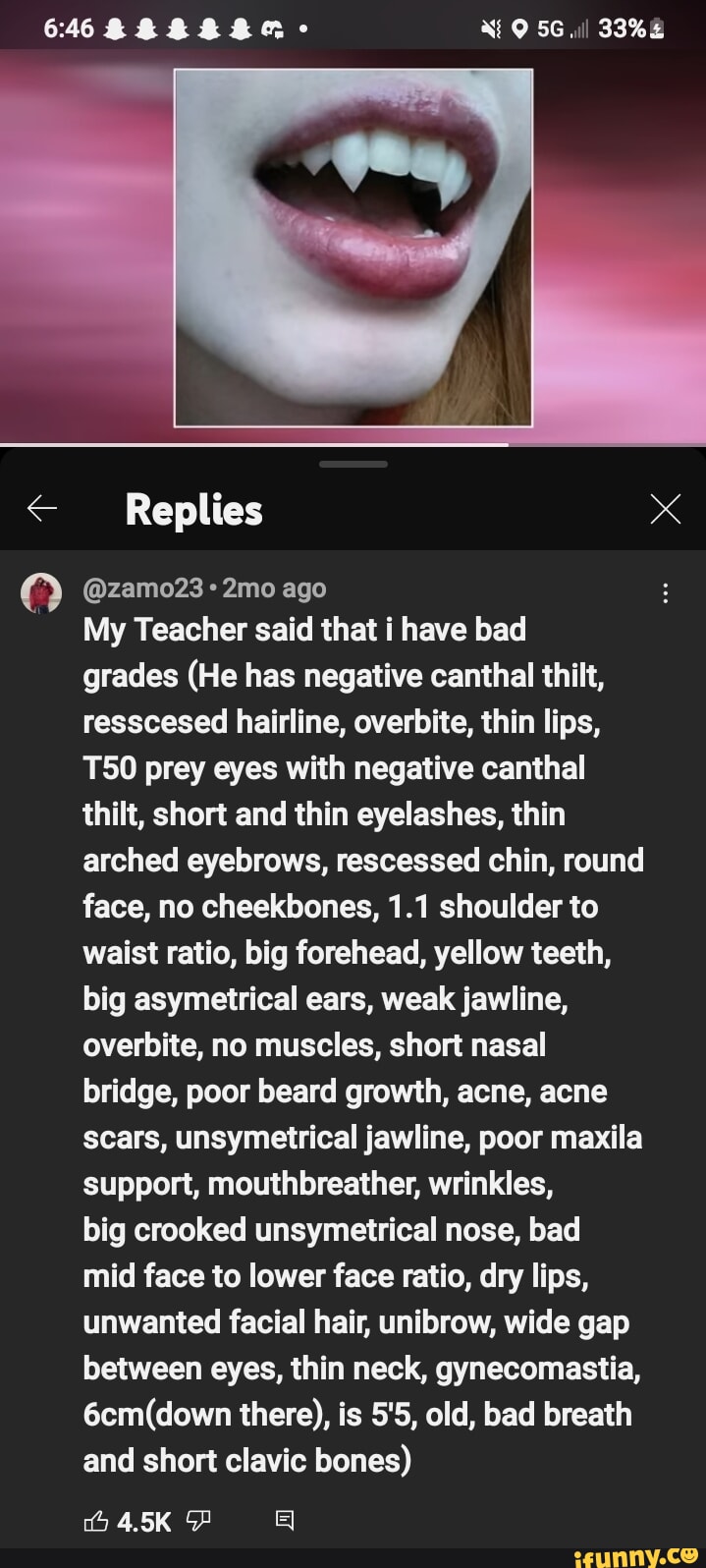 Overbite memes. Best Collection of funny Overbite pictures on iFunny