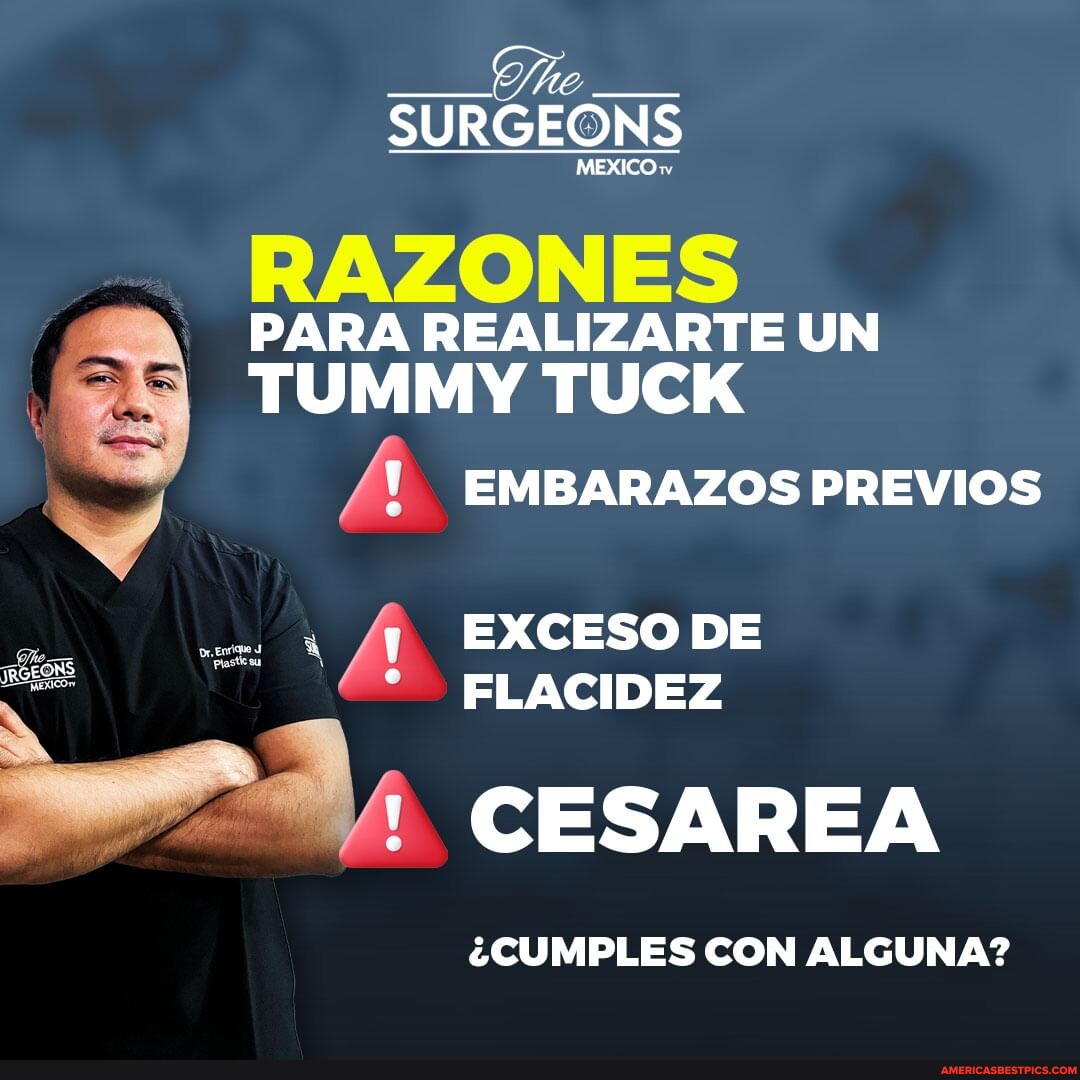 Un Tummy tuck tambin conocido como abdominoplastia es importante por ...