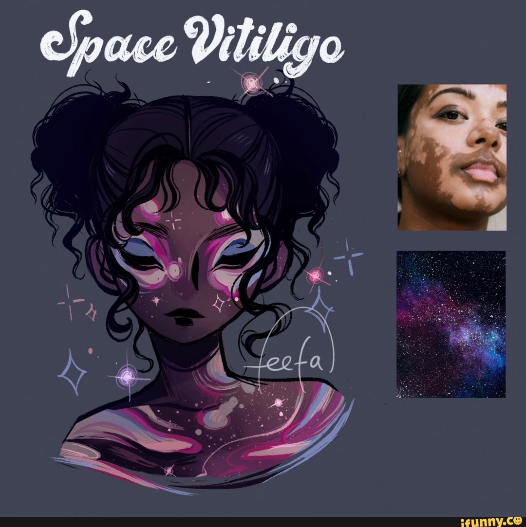 Vitiligo memes. Best Collection of funny Vitiligo pictures on iFunny