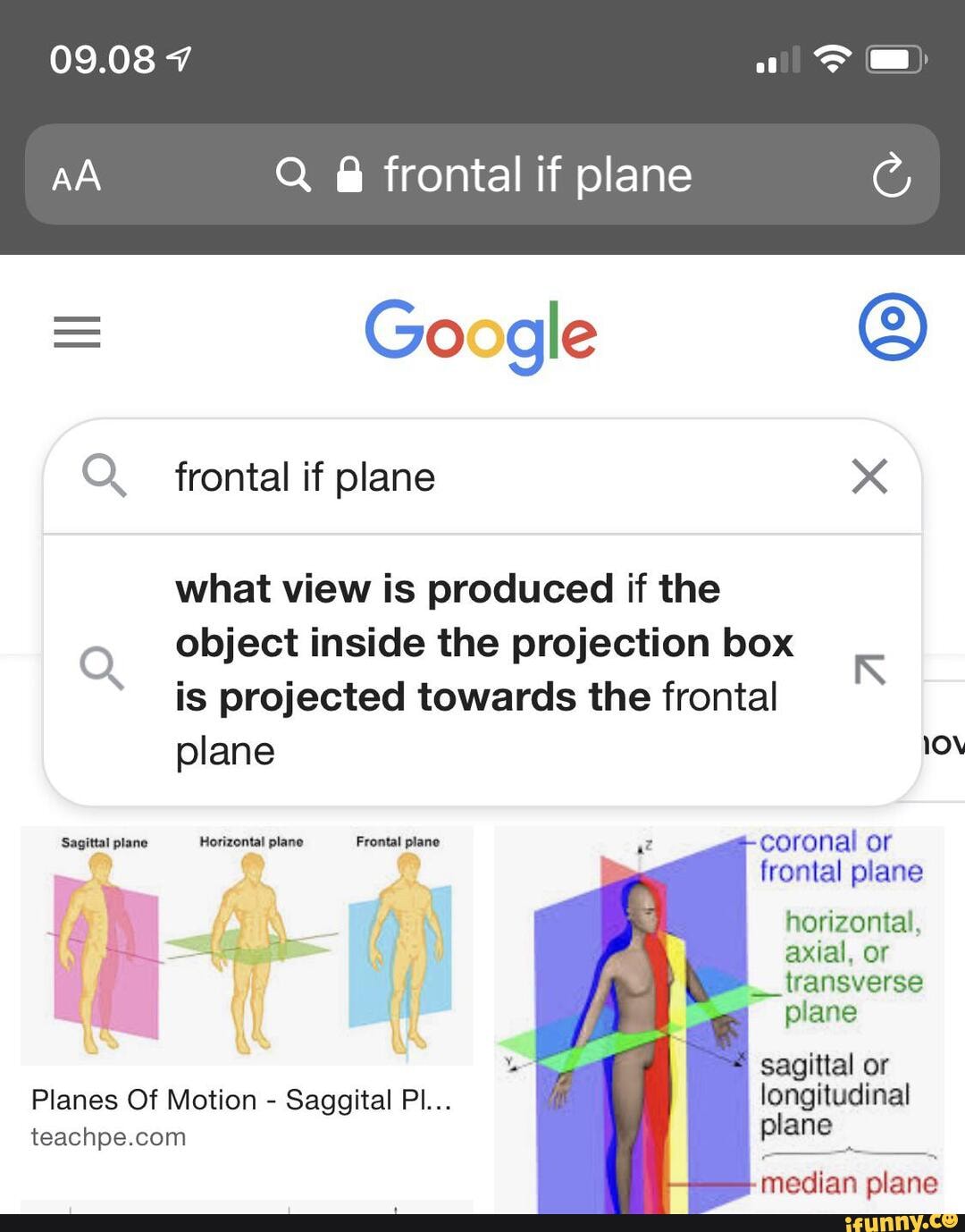 Sagittal memes. Best Collection of funny Sagittal pictures on iFunny