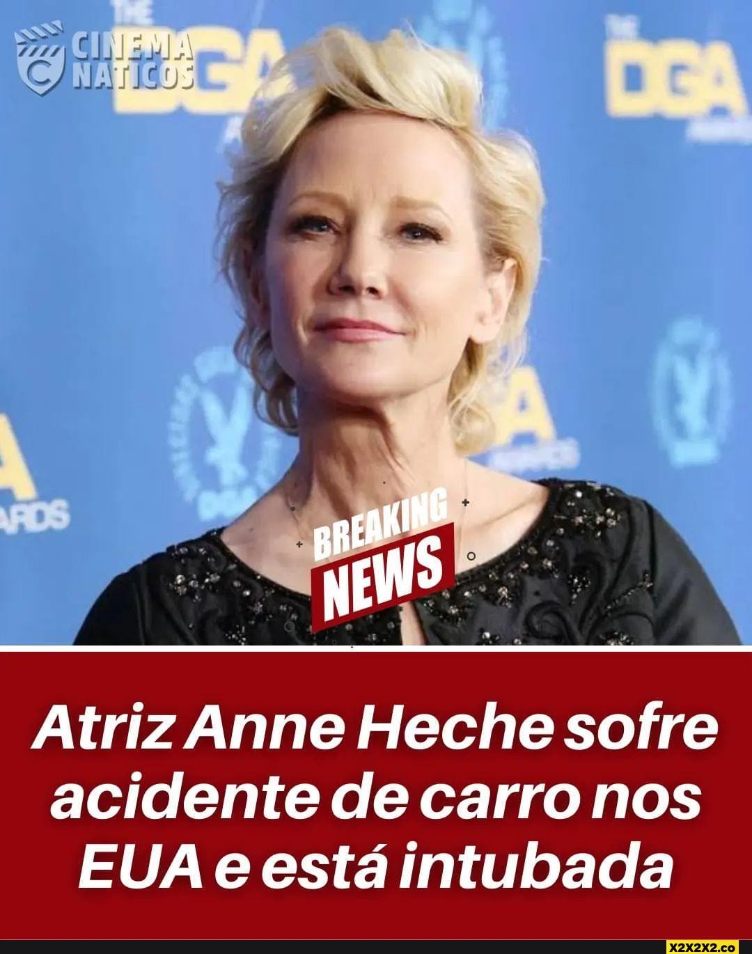 Atriz Anne Heche sofre acidente de carro nos EUA e está intubada - iFunny